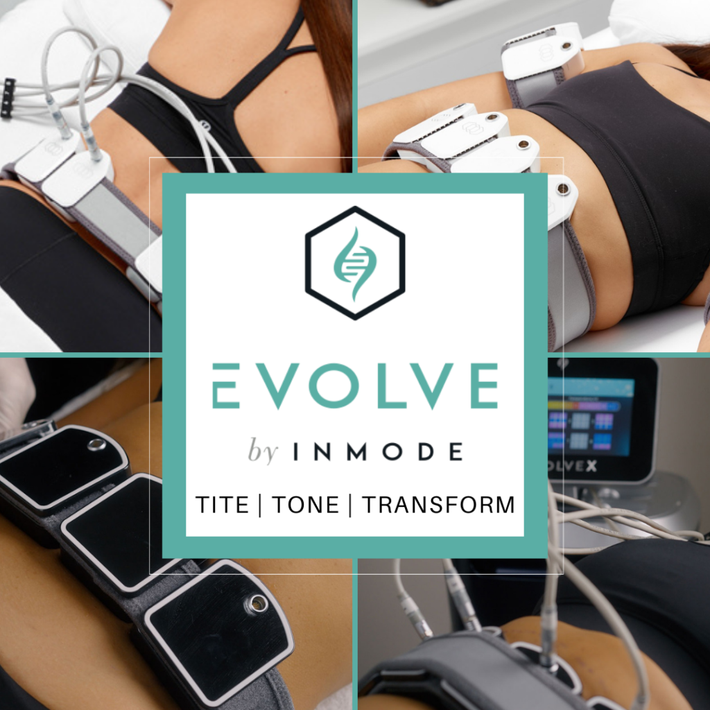 Body Sculpting with Evolve Radiofrequency - Sanctuary Health Practices